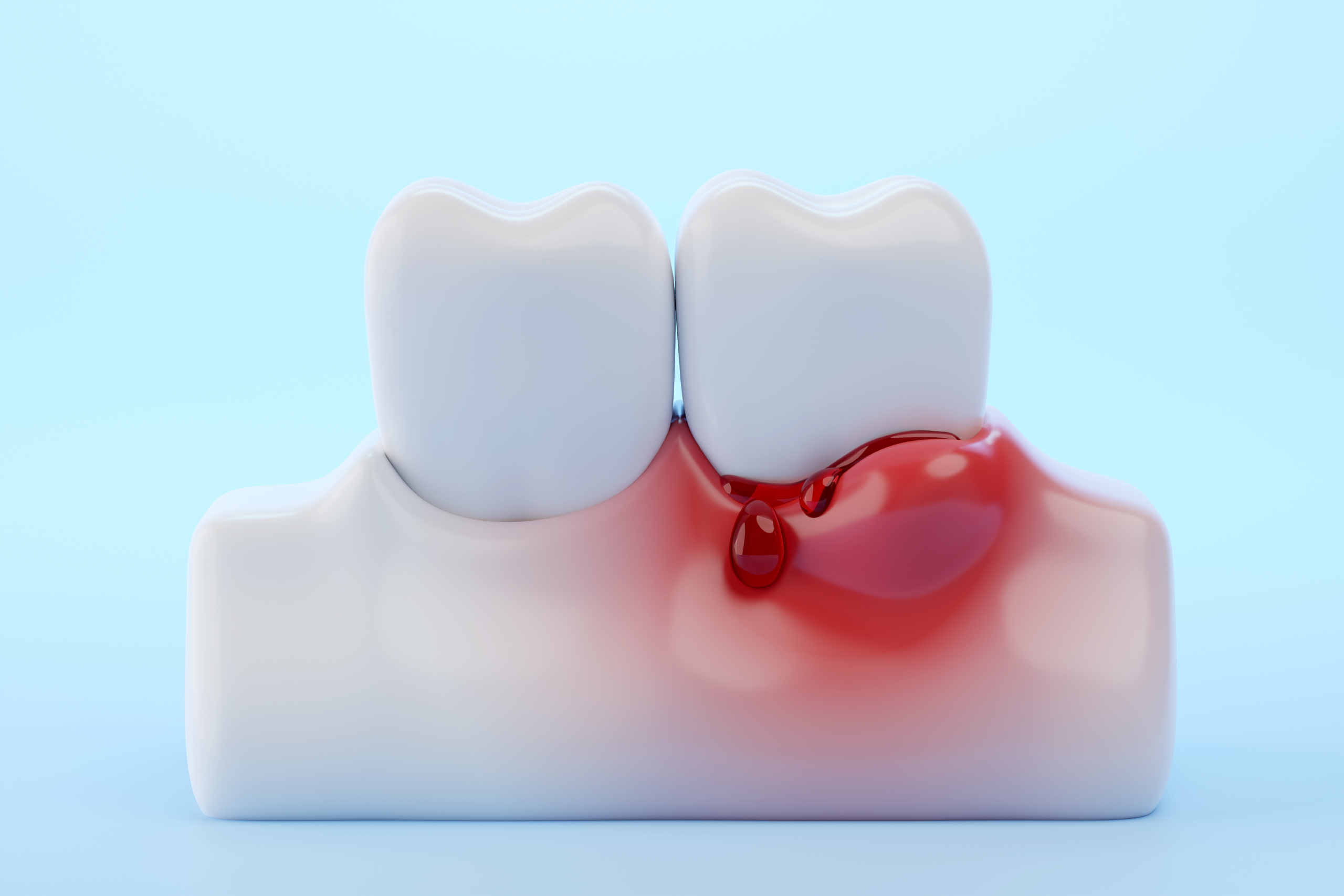 Understanding Common Gum Diseases and Other Oral Problems